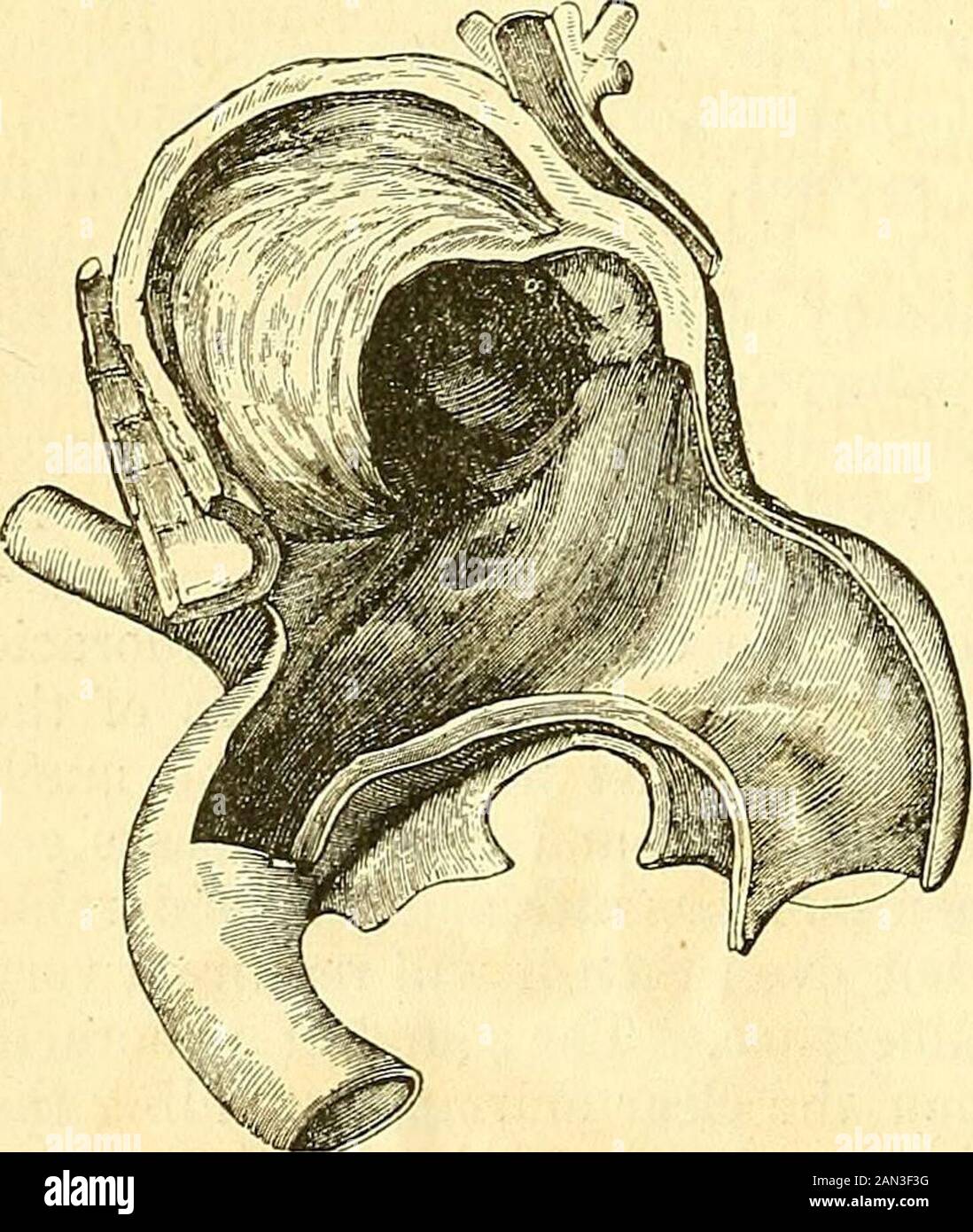Neck abscess hi-res stock photography and images - Alamy