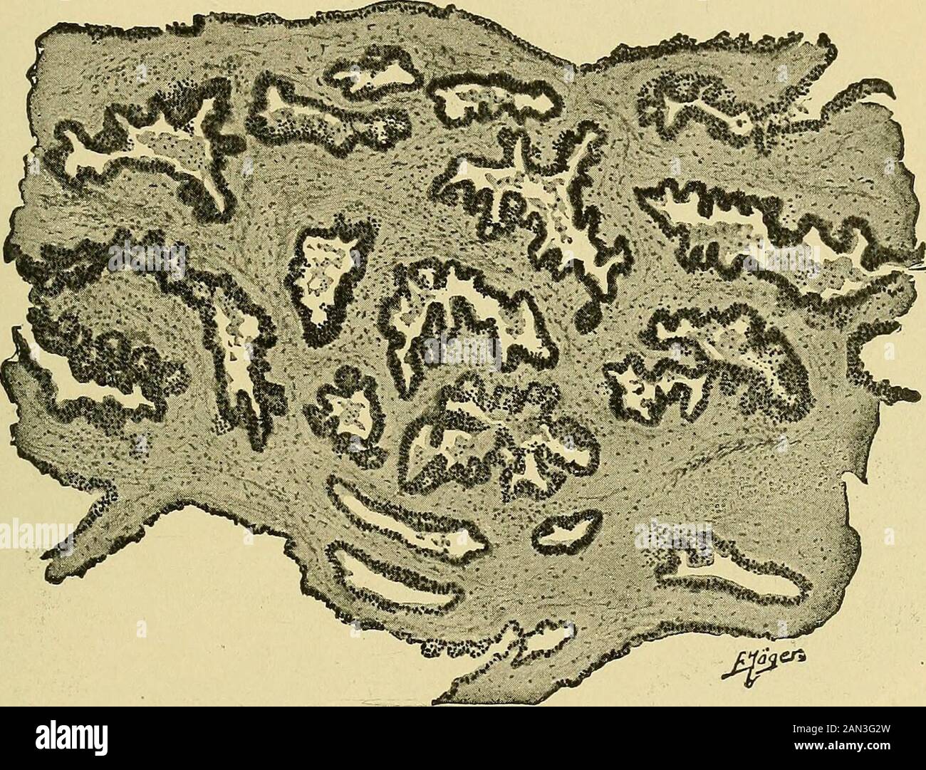 Connective tissue capsule hi-res stock photography and images - Alamy