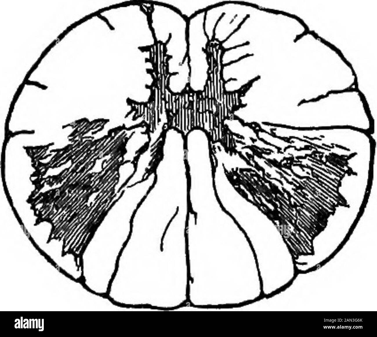 Brain Transverse Section Black and White Stock Photos & Images - Alamy
