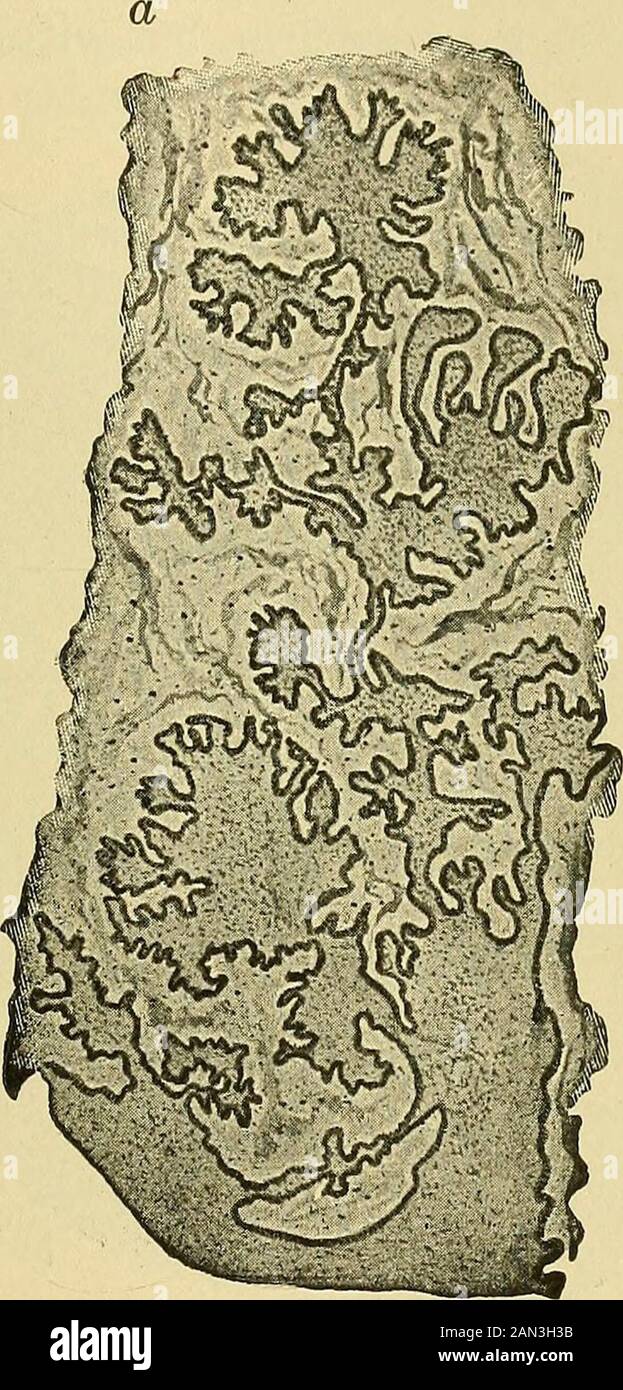 Pathology and treatment of diseases of women . -Jtfoger? Fig. 170 ...