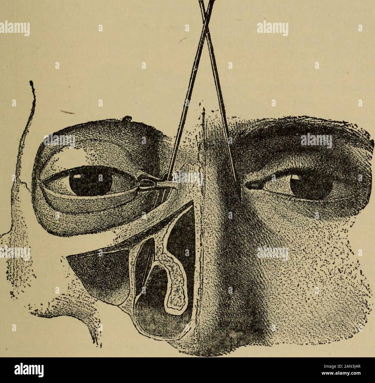 Text-book of ophthalmology . one merges into thebony canal the ...