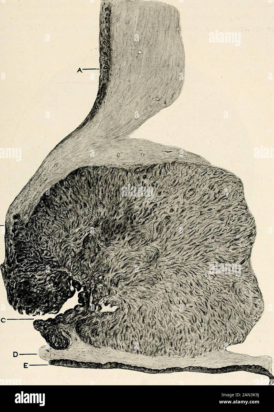 Gynaecology for students and practitioners . rior lip of cervix. P.L.C ...