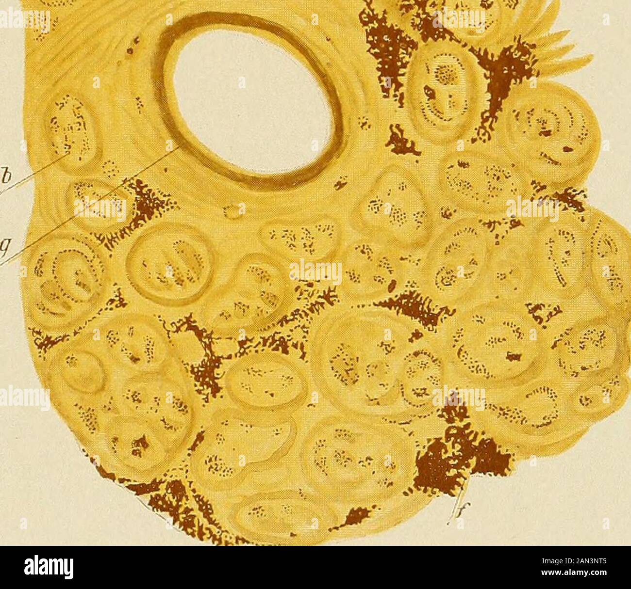 Brachial plexus injury hi-res stock photography and images - Alamy