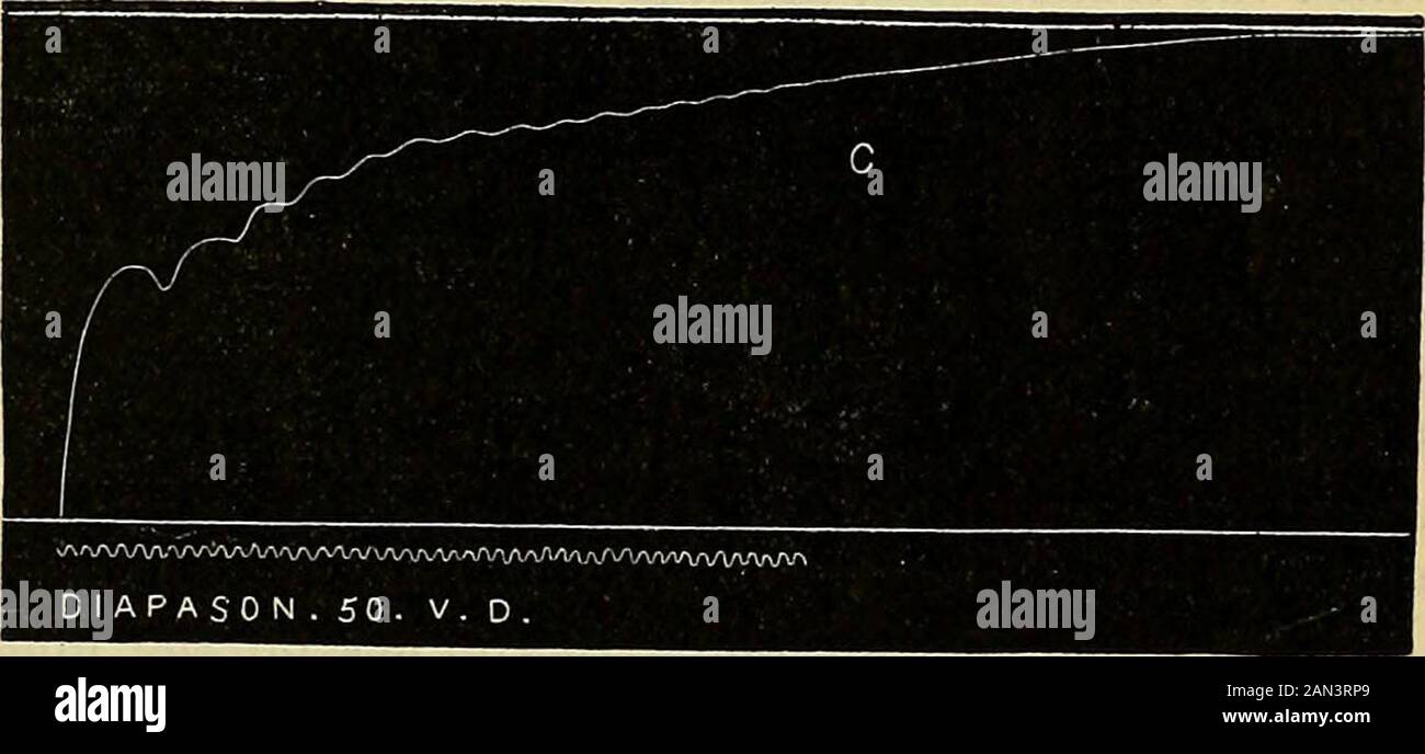 Muscle physiology drawing hi-res stock photography and images - Alamy