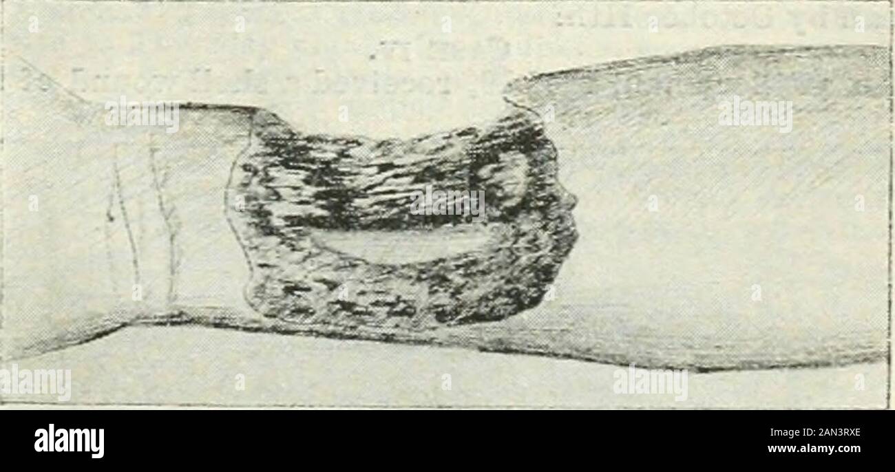 British medical journal . ts or shrapnel shell casing, but he was so ...