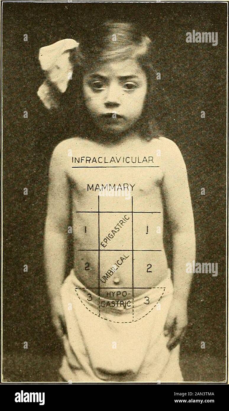 Intestines Forming High Resolution Stock Photography and Images - Alamy