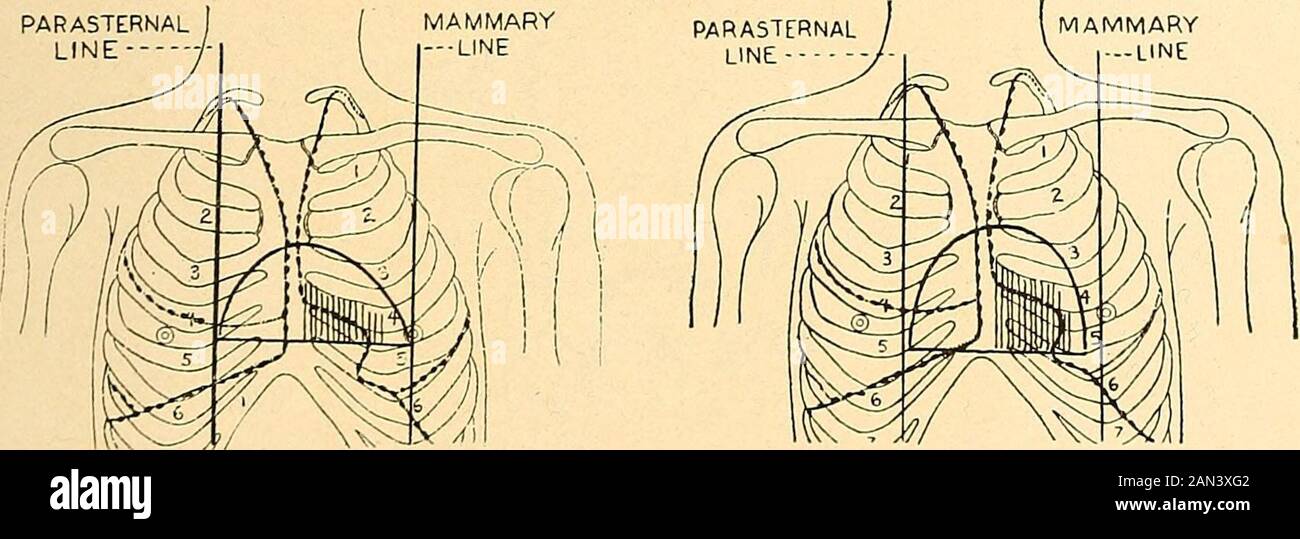 Fourth rib hi-res stock photography and images - Alamy