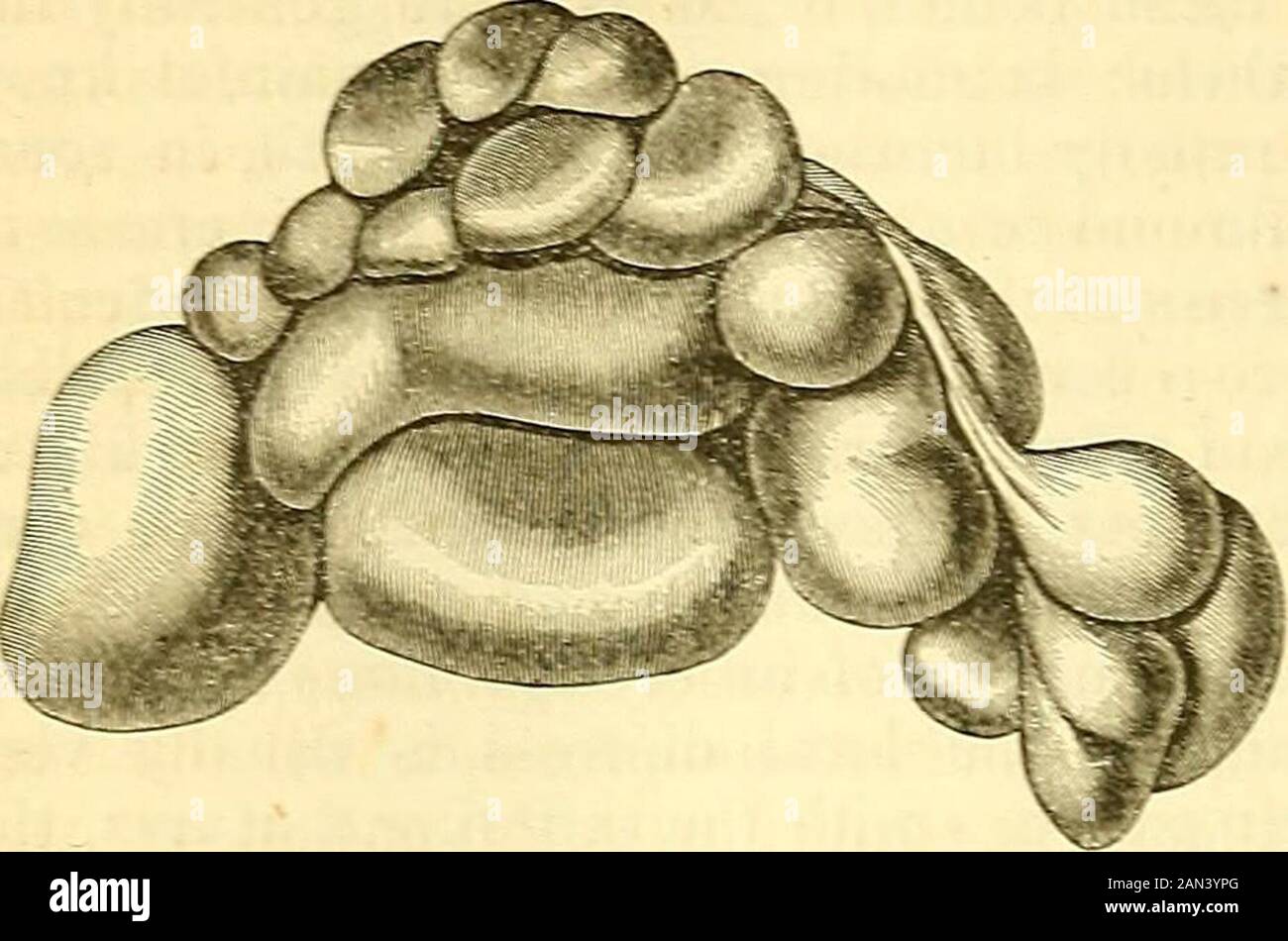 Scrofulous hi-res stock photography and images - Alamy