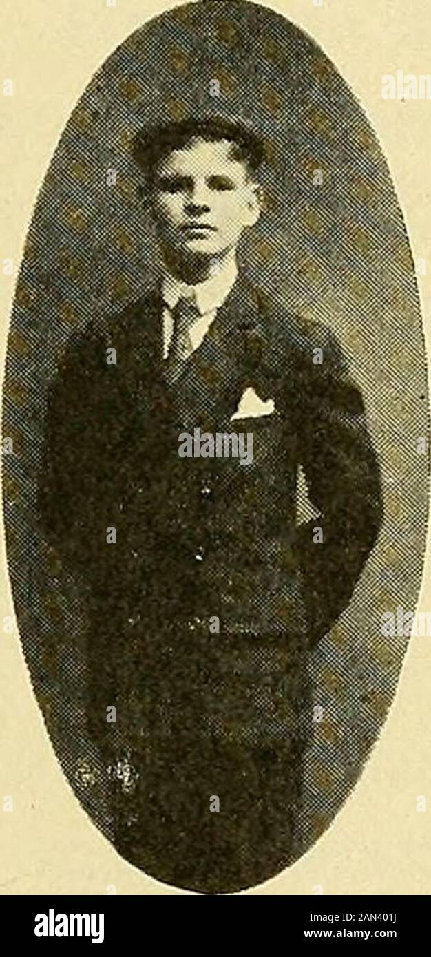 Types of mental defectives . Case B Stock Photo - Alamy