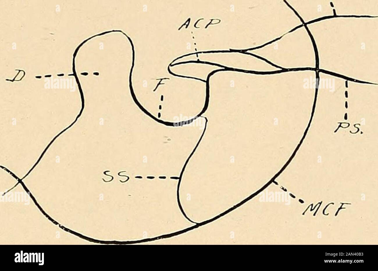 Roentgen diagnosis of diseases of the head . MCF Fig. 35.—A type of ...