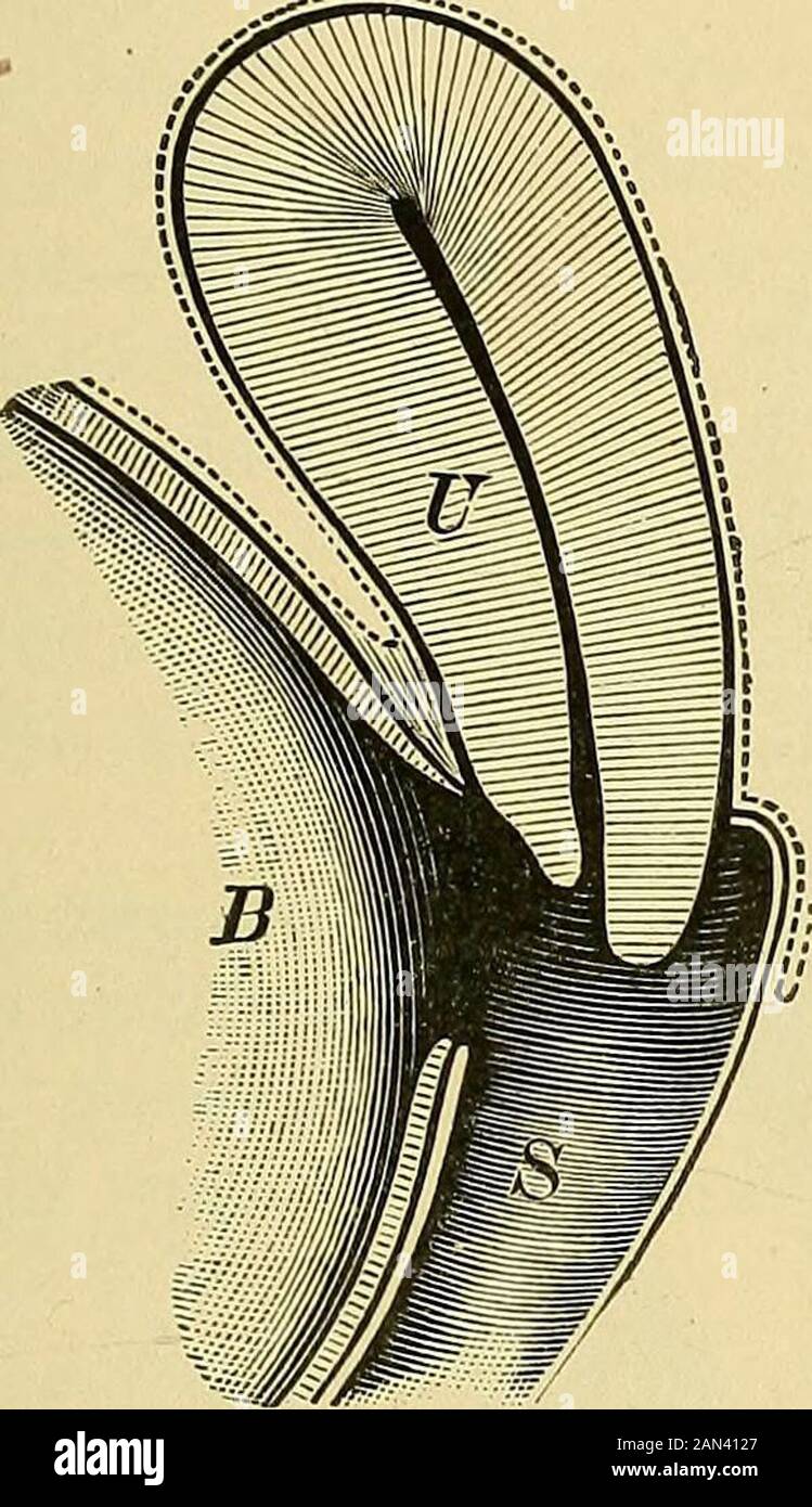 Pathology and treatment of diseases of women . agina in large fistulae ...