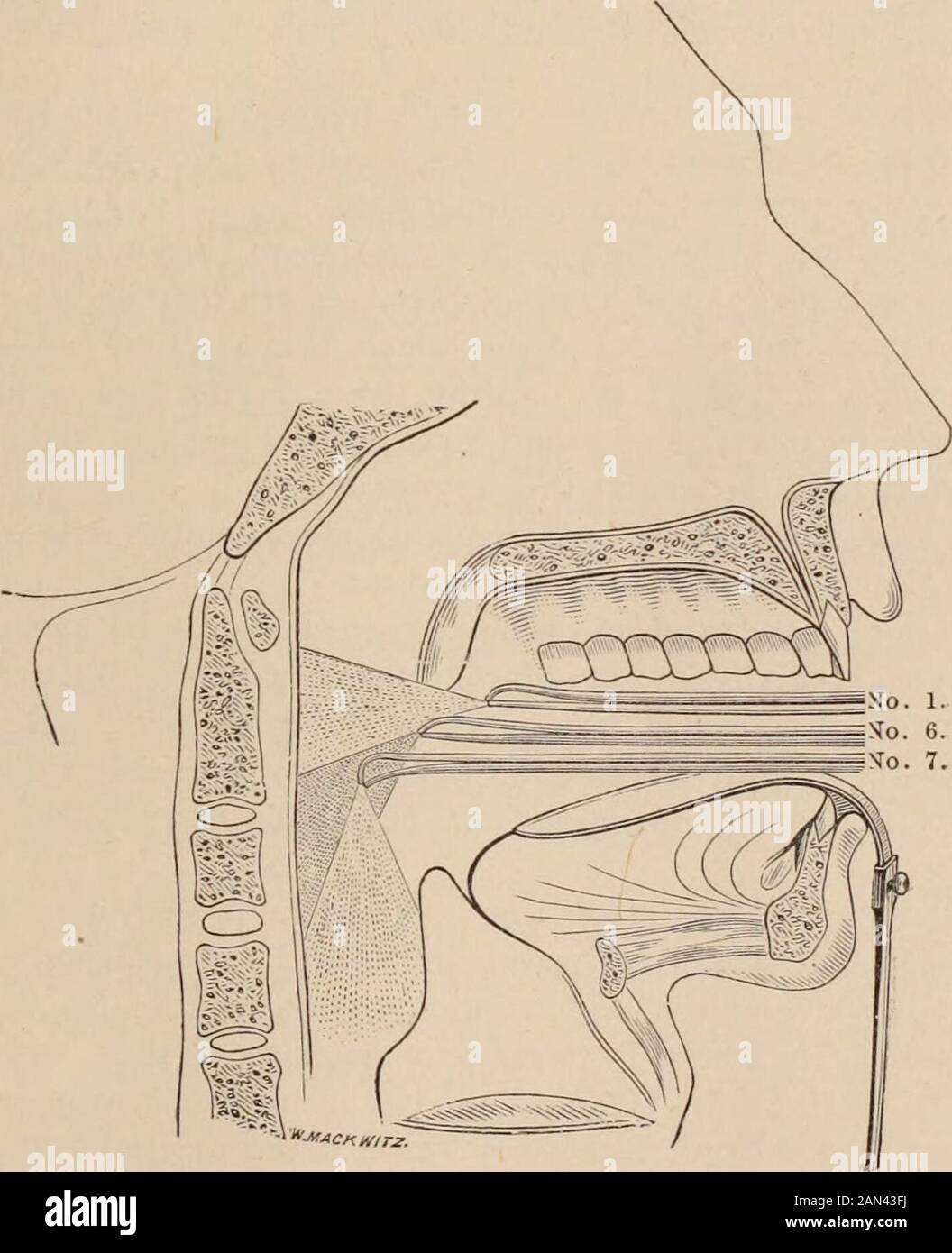 Gaillard's medical journal . Spray Producers for Making Local ...