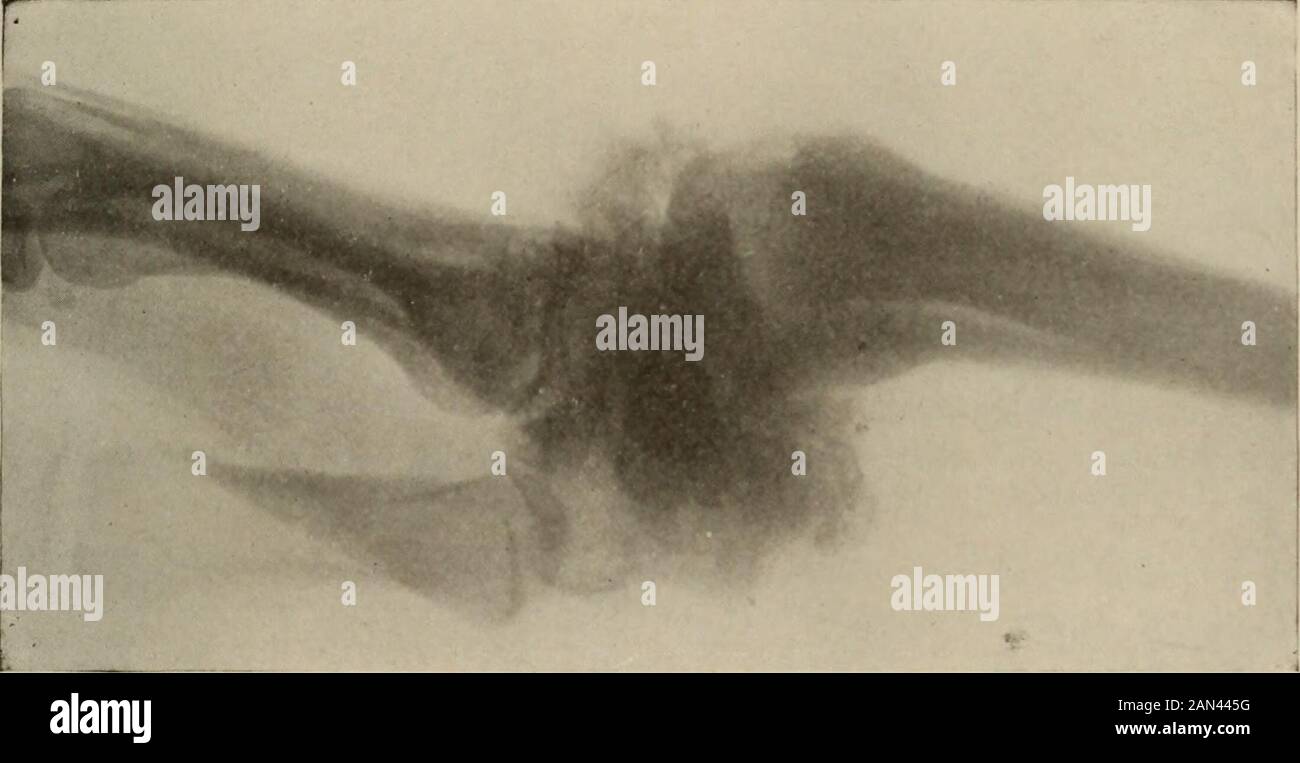 Cutaneous associated hi-res stock photography and images - Alamy