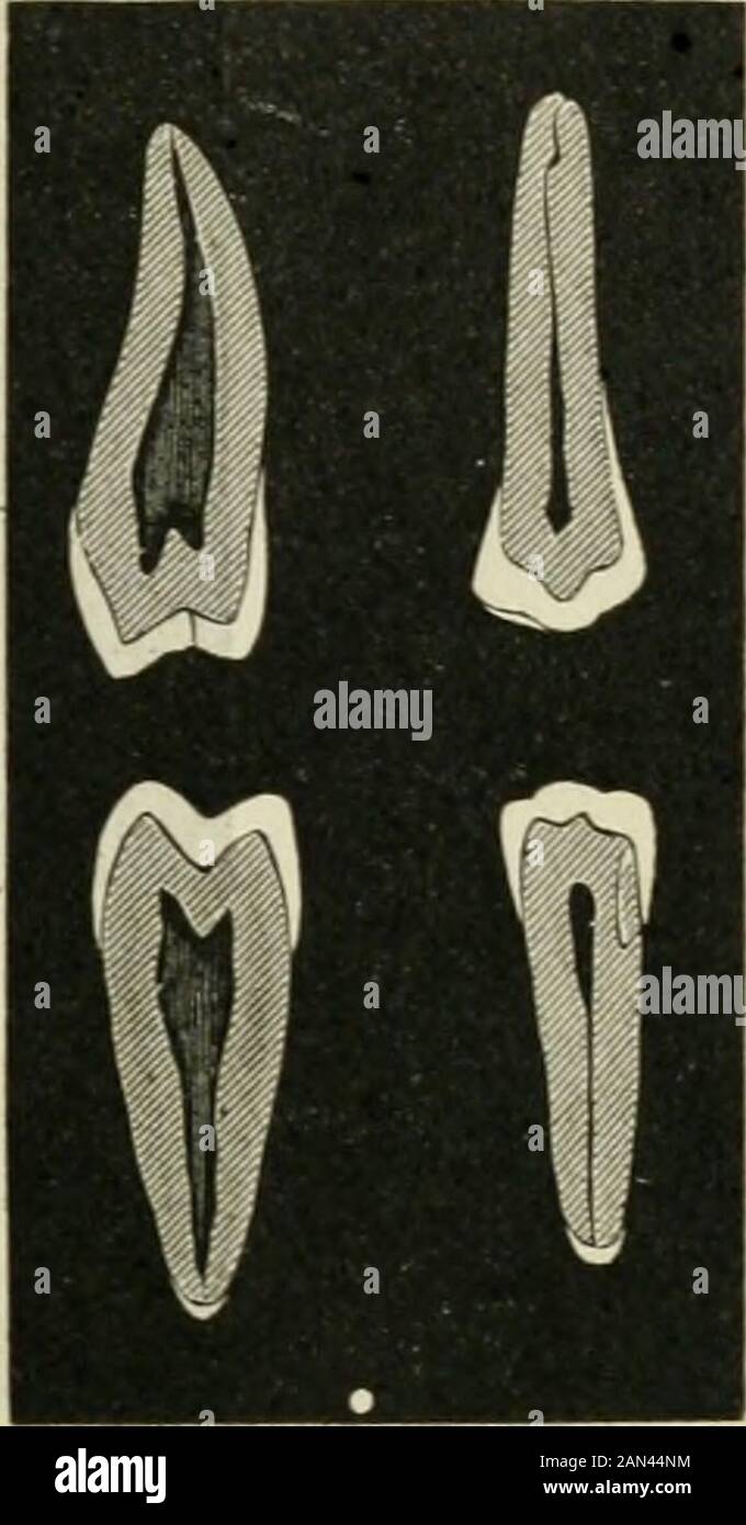 Transactions of the Illinois State Dental Society, 1892 . PLATE III ...