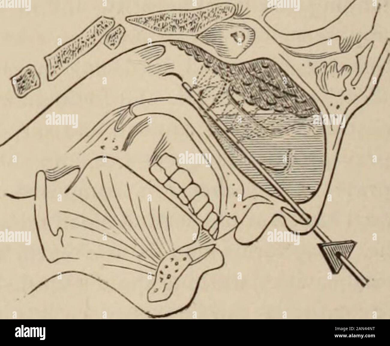 Gaillard's medical journal . Anterior-posterior sectionof the head ...