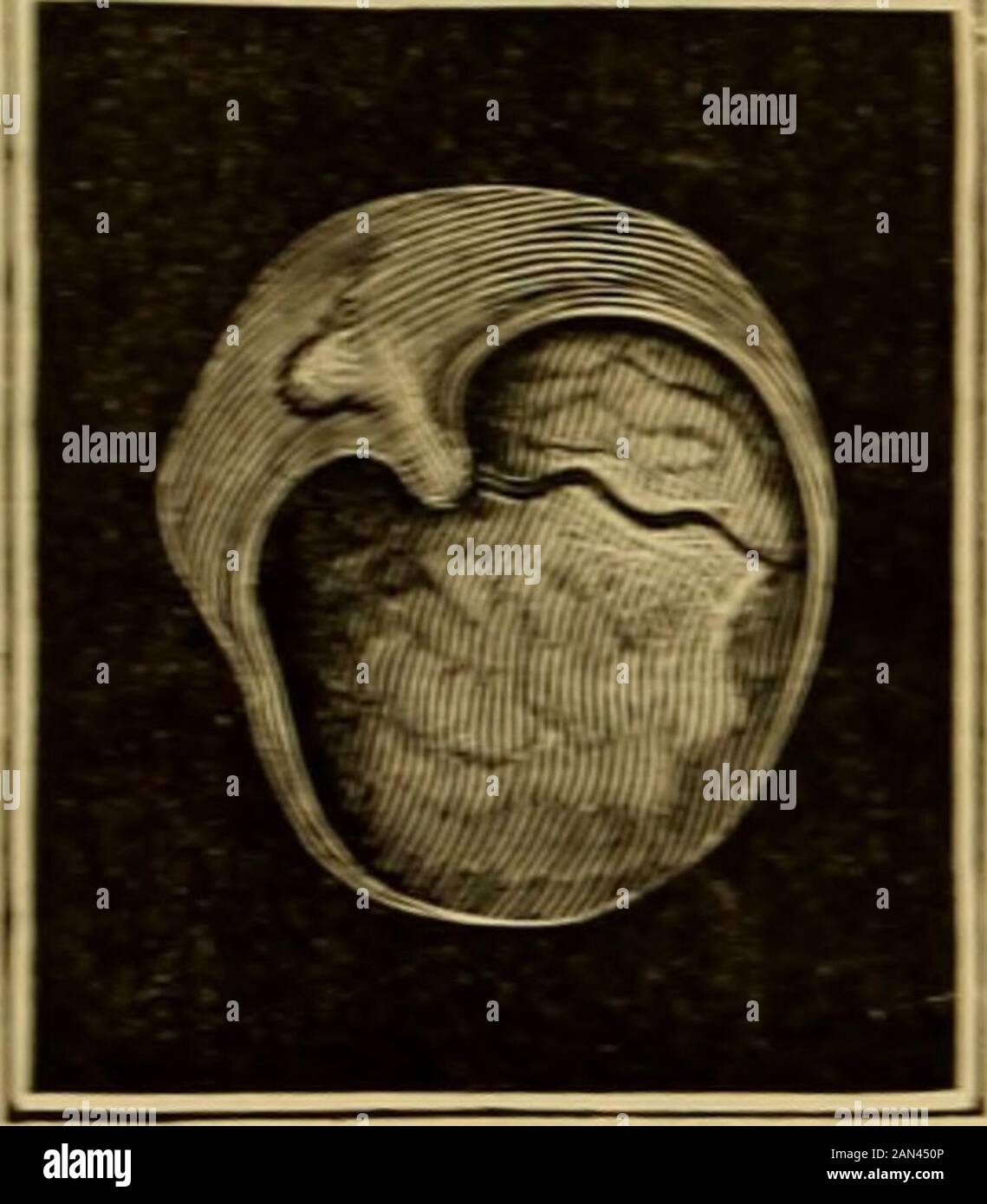 Tympanic Cavity High Resolution Stock Photography and Images - Alamy