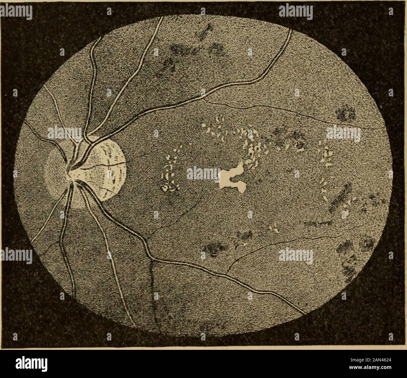 Visual disturbance hi-res stock photography and images - Alamy