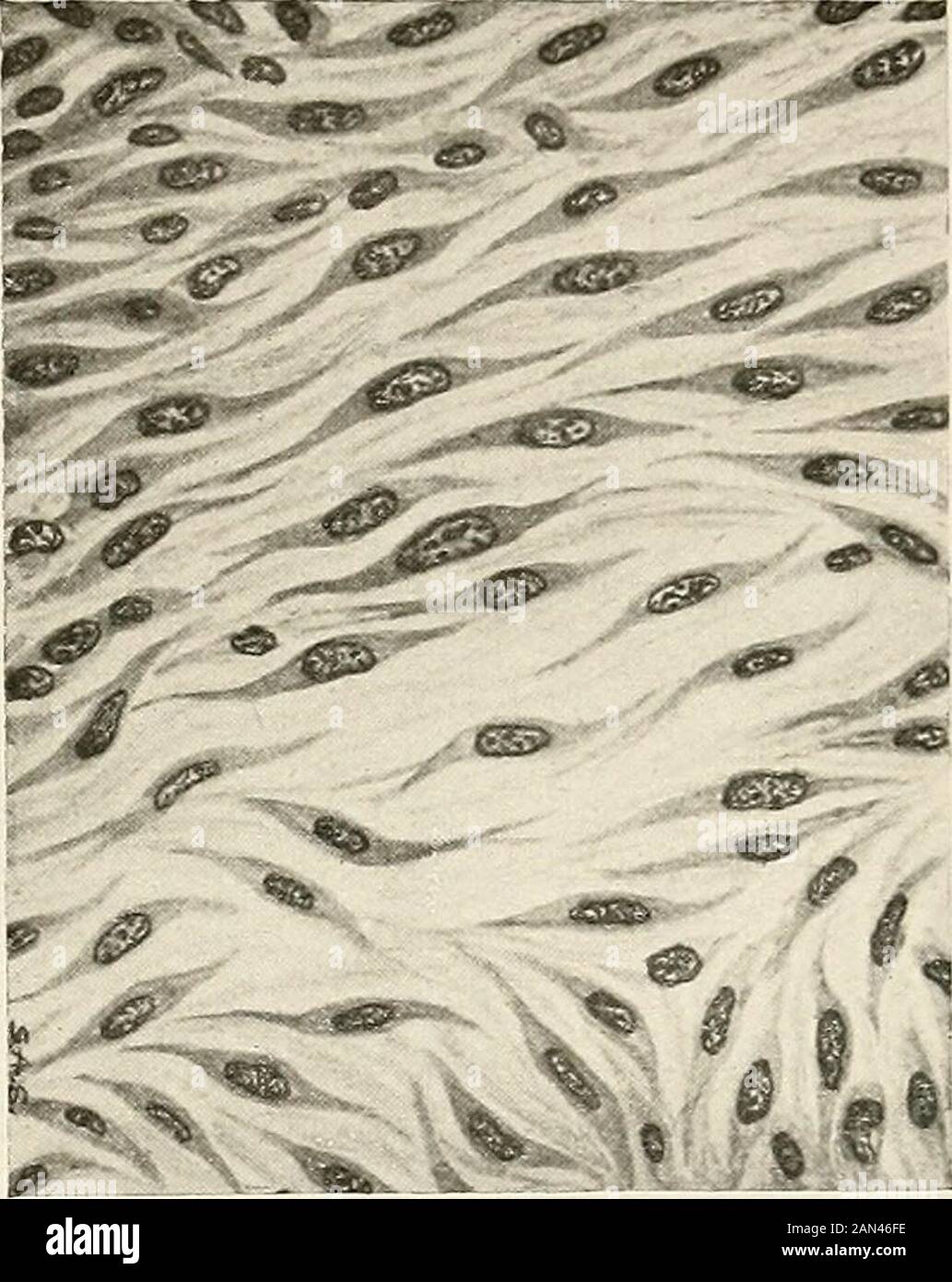 Gynaecology for students and practitioners . Fig. 227. Sakcomatou ...