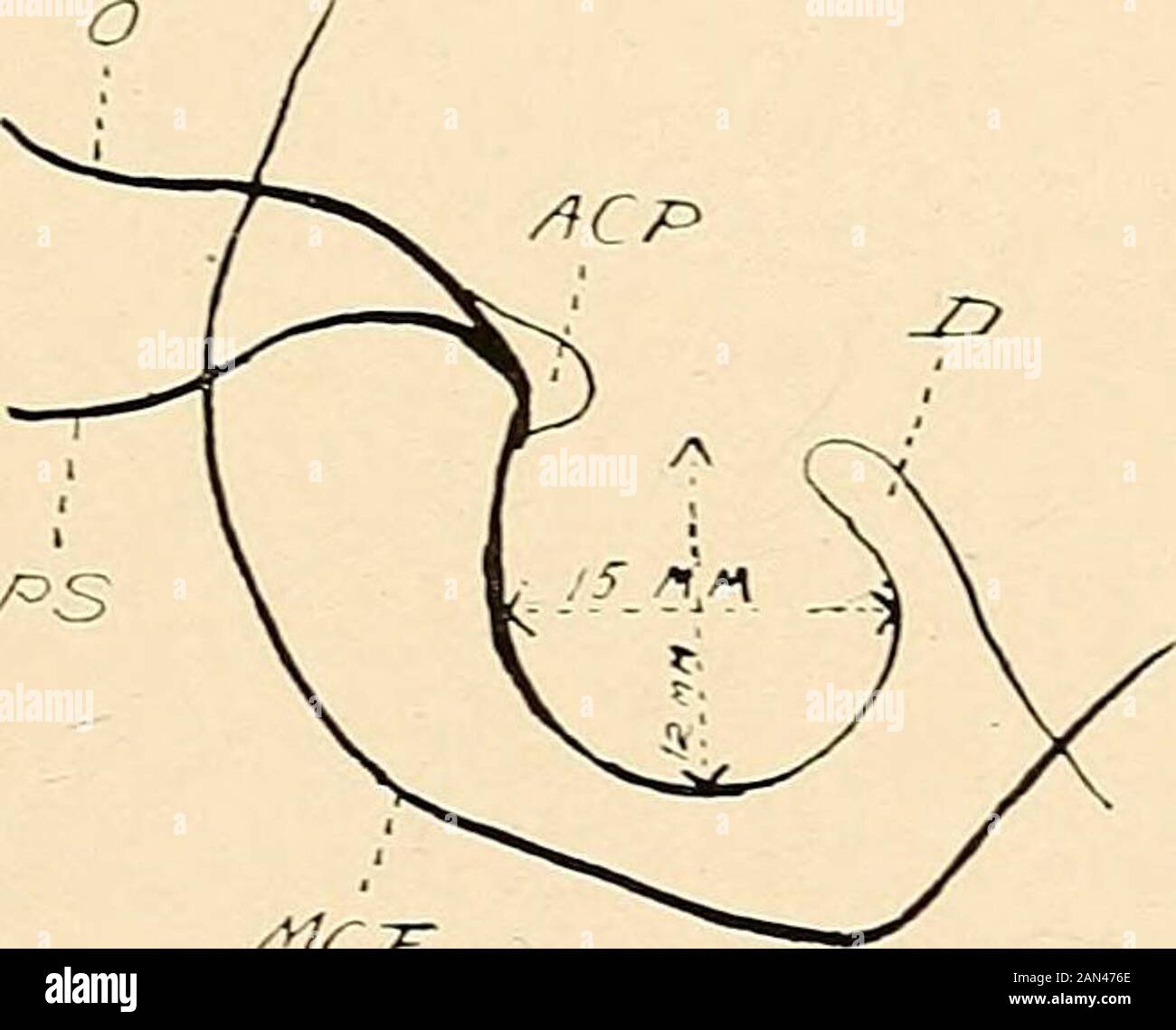 Adult cretin hi-res stock photography and images - Alamy