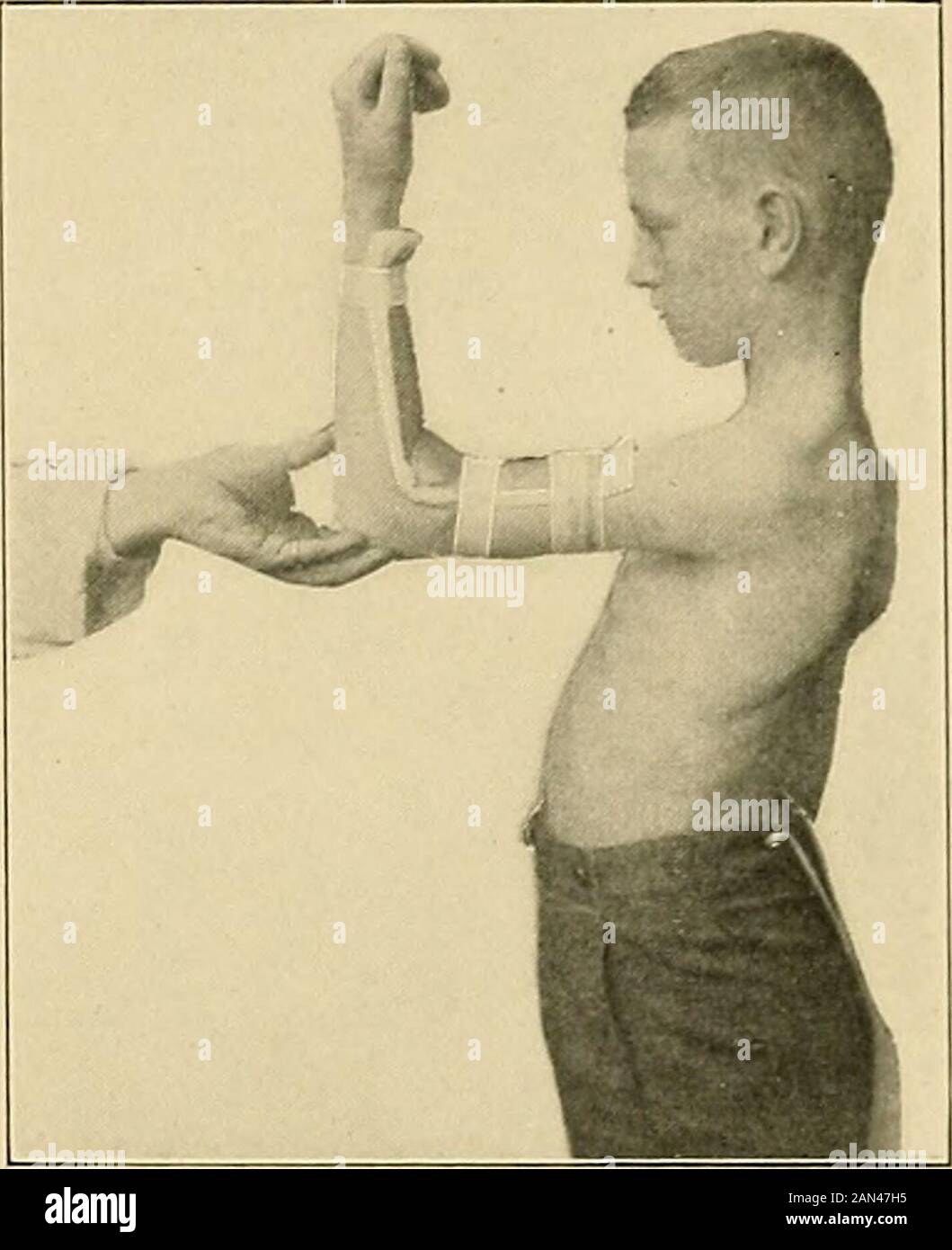 Swelling Arm High Resolution Stock Photography and Images - Alamy