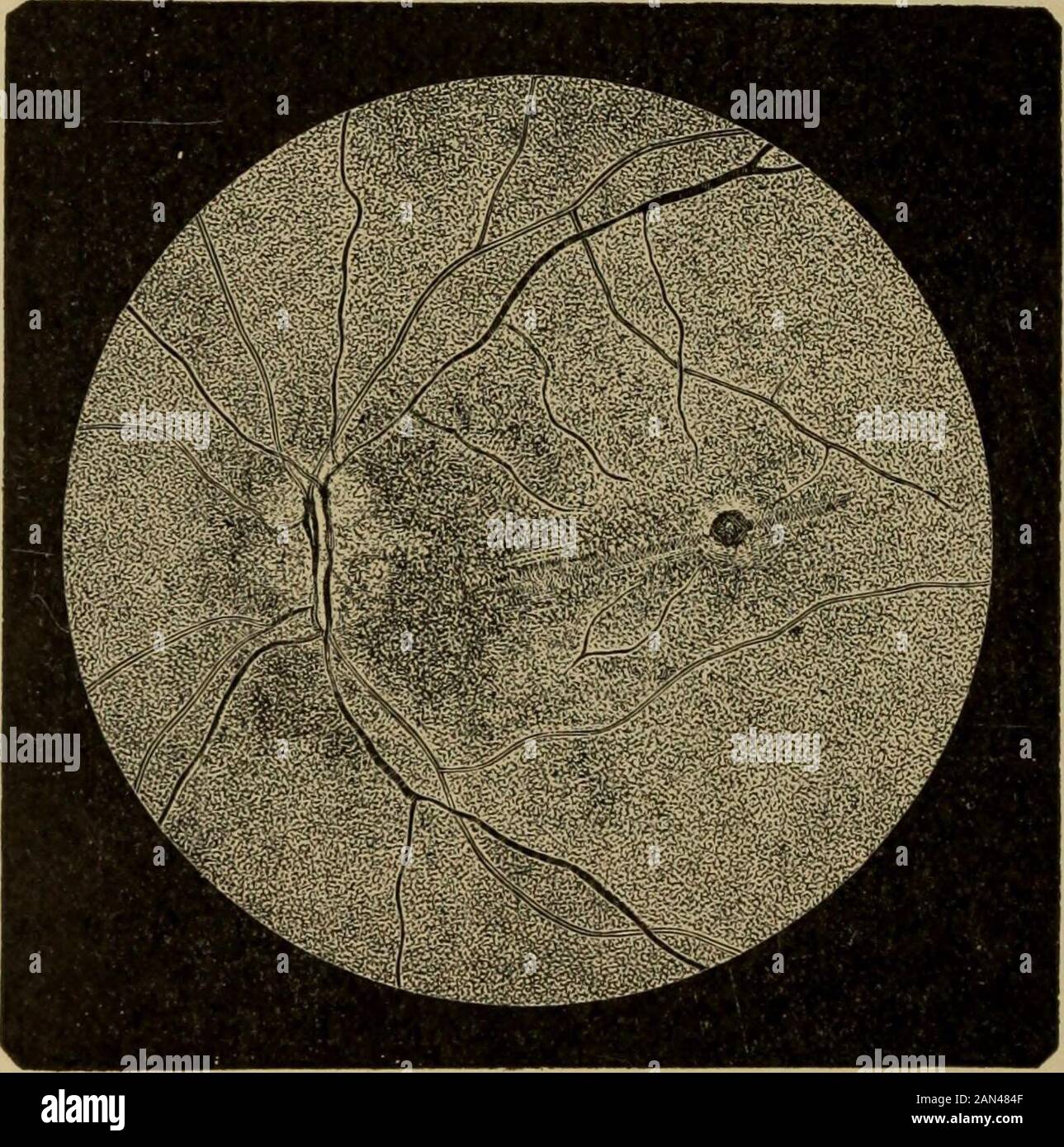 Retinal layers hi-res stock photography and images - Alamy