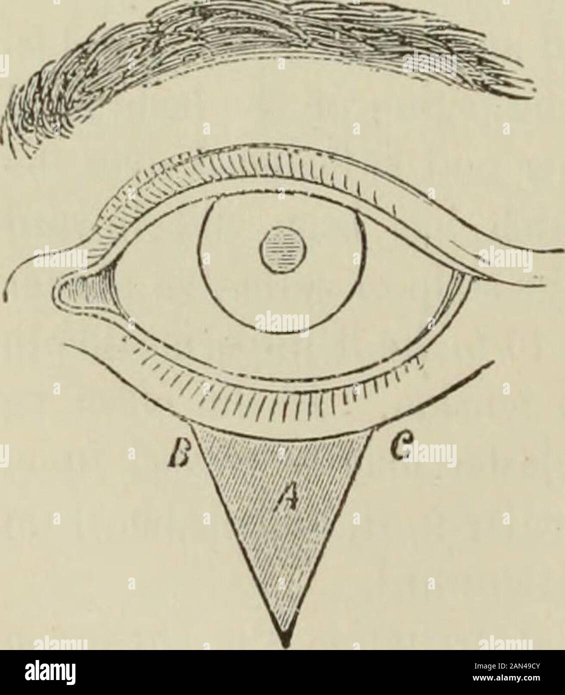 Cicatrize hi-res stock photography and images - Alamy