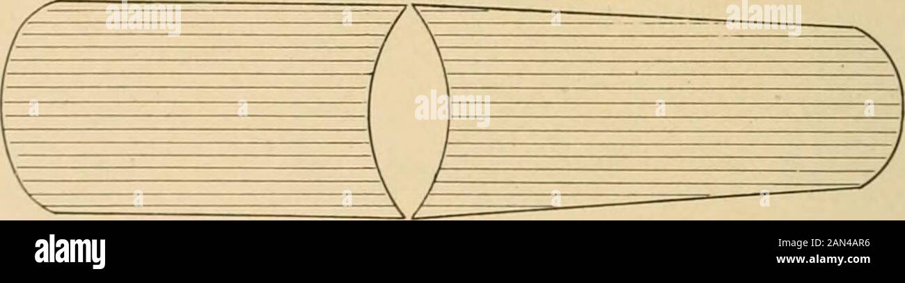 The treatment of fractures . Fig. 218.—Method of manufacture of tin ...