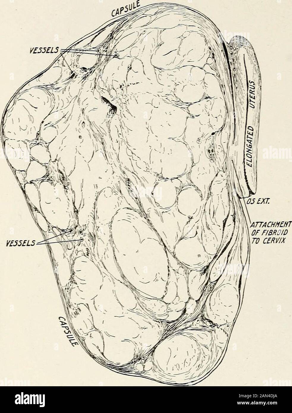 Gynaecology for students and practitioners . OS EXT. Fig. 218 ...