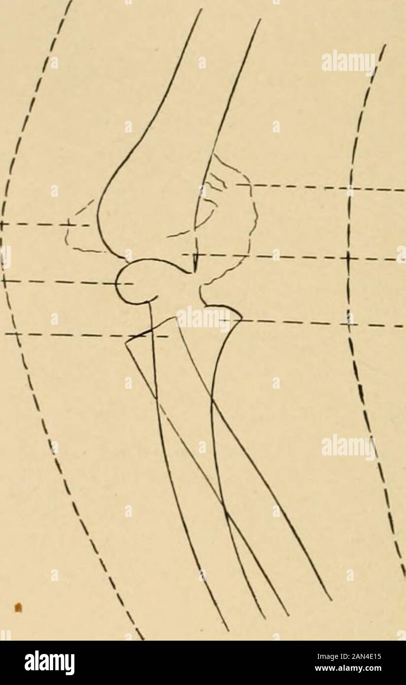 The treatment of fractures . enosteum. ower epiphysis ofhumerus. [ Ulna ...