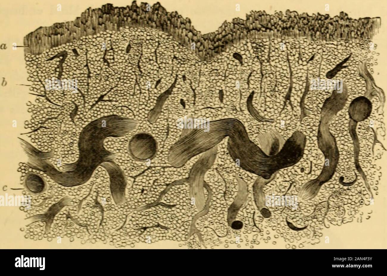 A text-book of the diseases of the ear and adjacent organs . CHRONIC ...