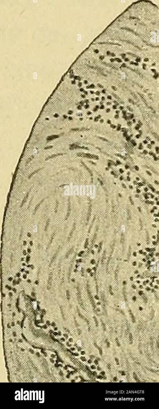 Perimetrium hi-res stock photography and images - Alamy