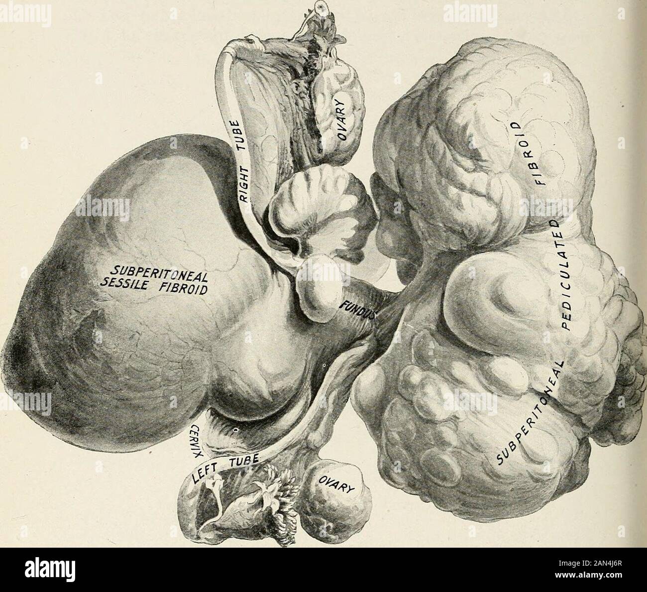 Gynaecology for students and practitioners . f adenomyomata, and these ...