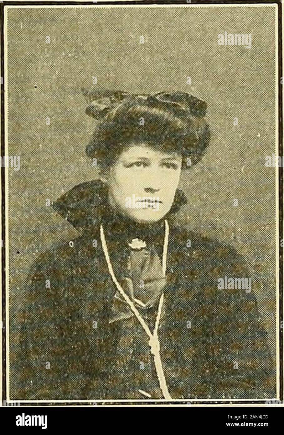 Types of mental defectives . Case I Stock Photo - Alamy