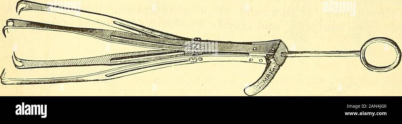 A system of surgery : pathological, diagnostic, therapeutic, and ...