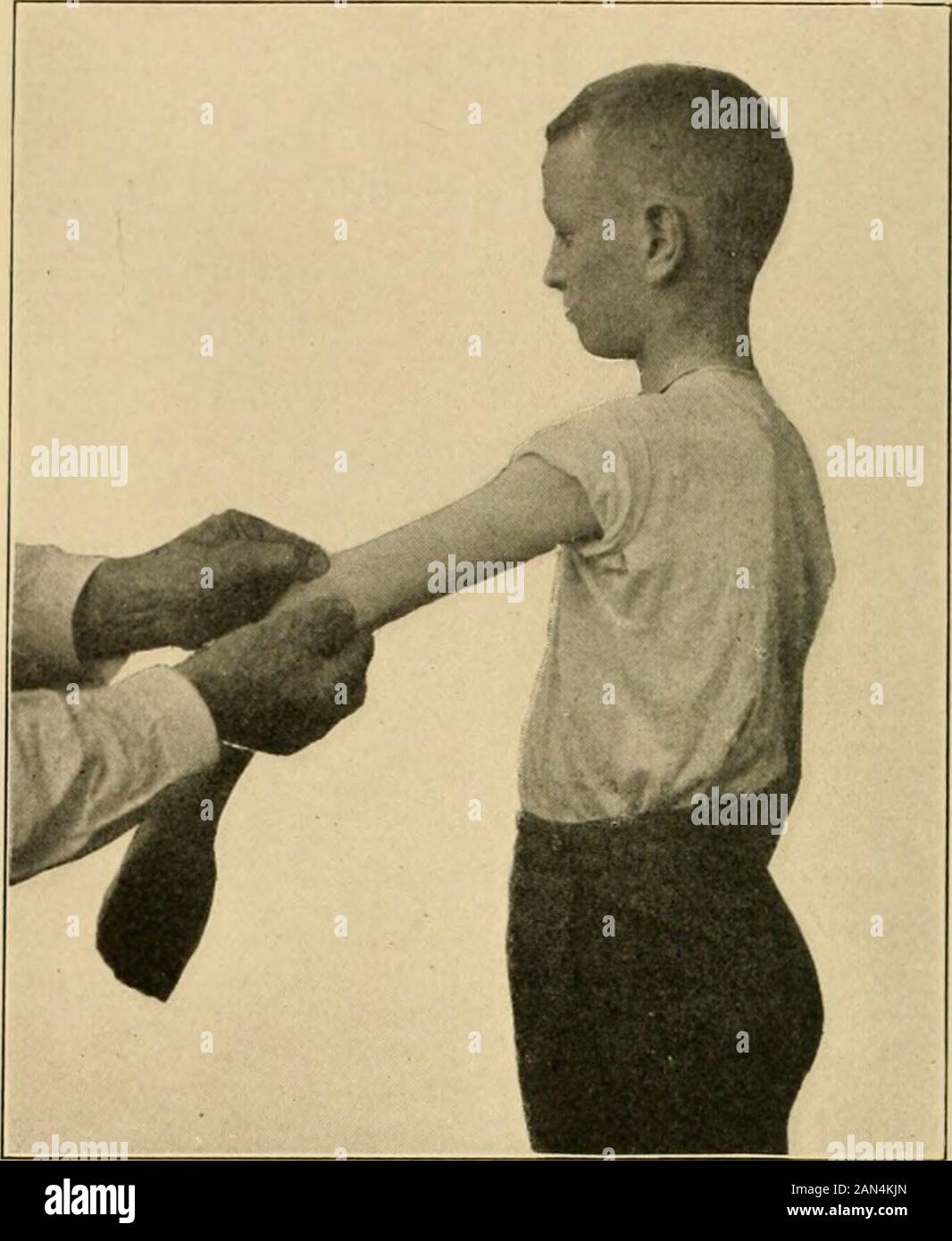 Olecranon process hi-res stock photography and images - Alamy