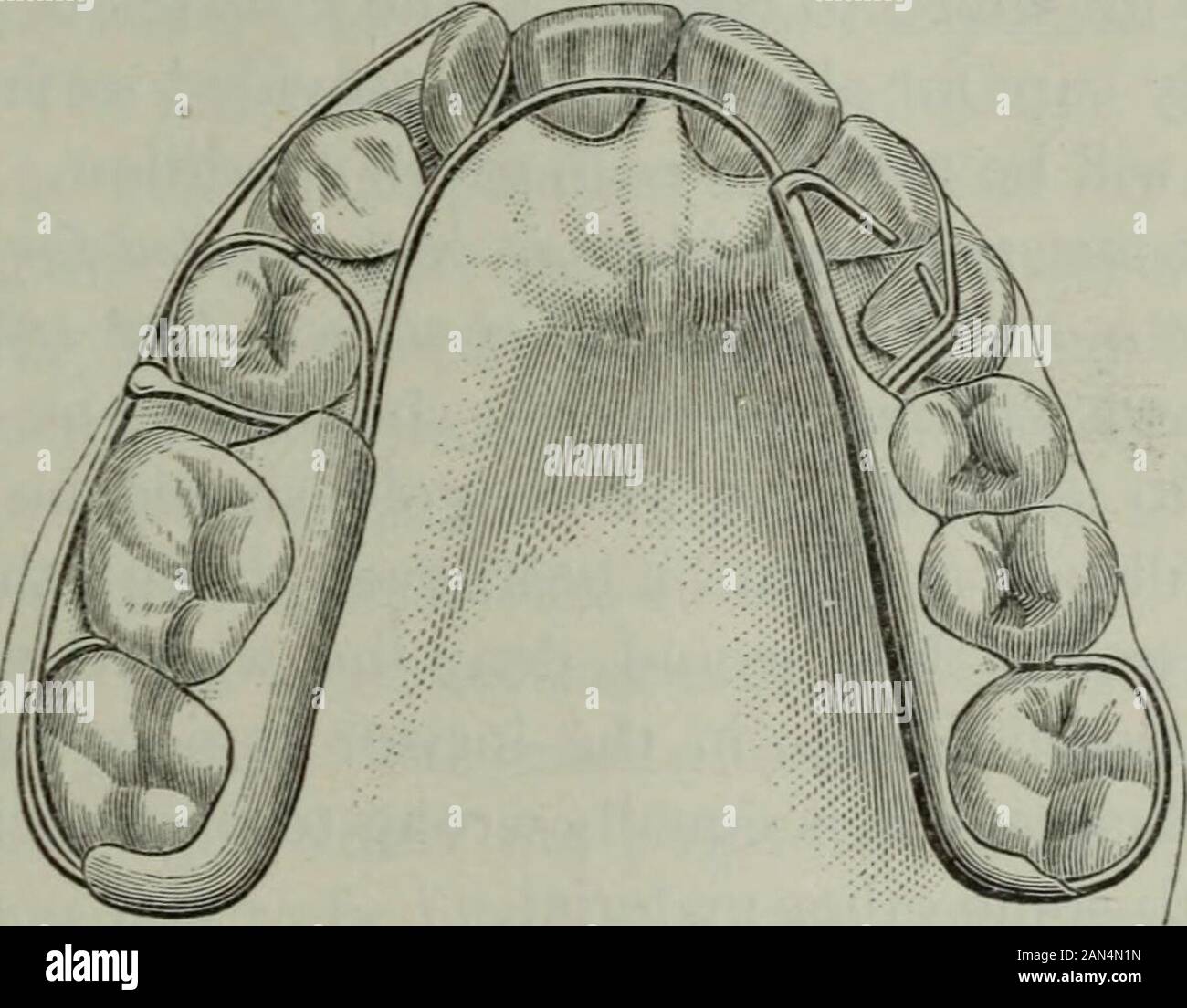 Retained tooth hi-res stock photography and images - Alamy