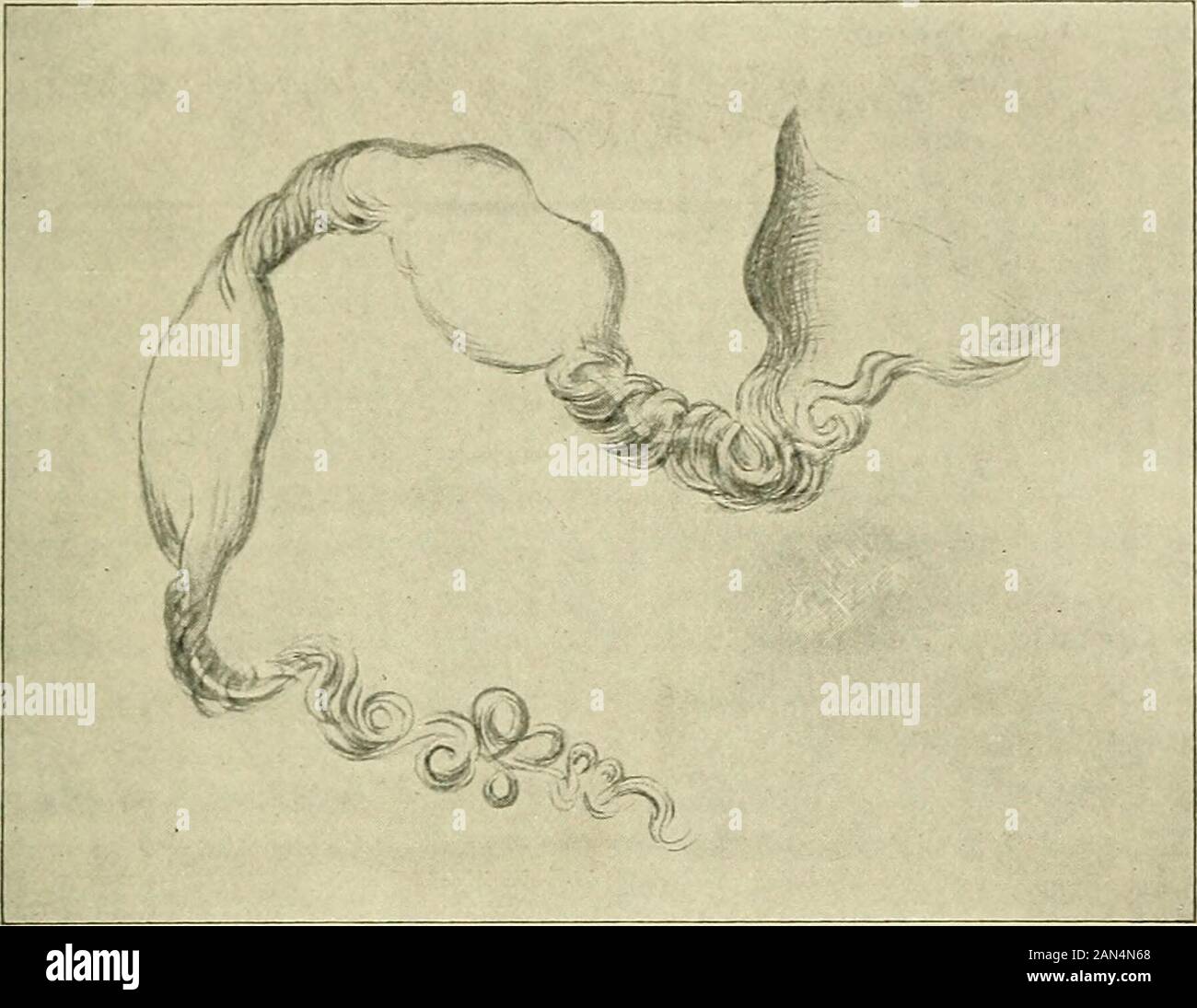 Fibrin Weigert Stain Method