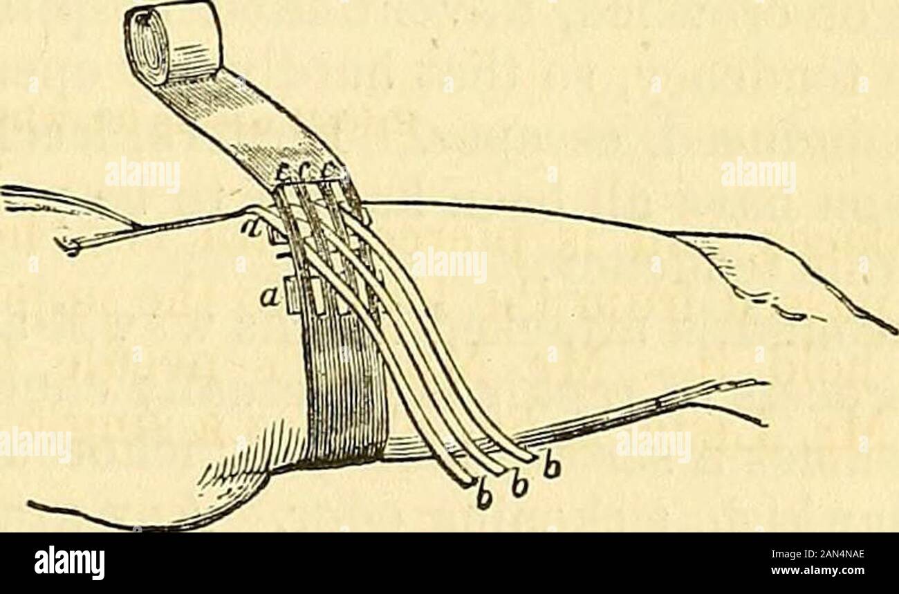 Groin wounds hi-res stock photography and images - Alamy