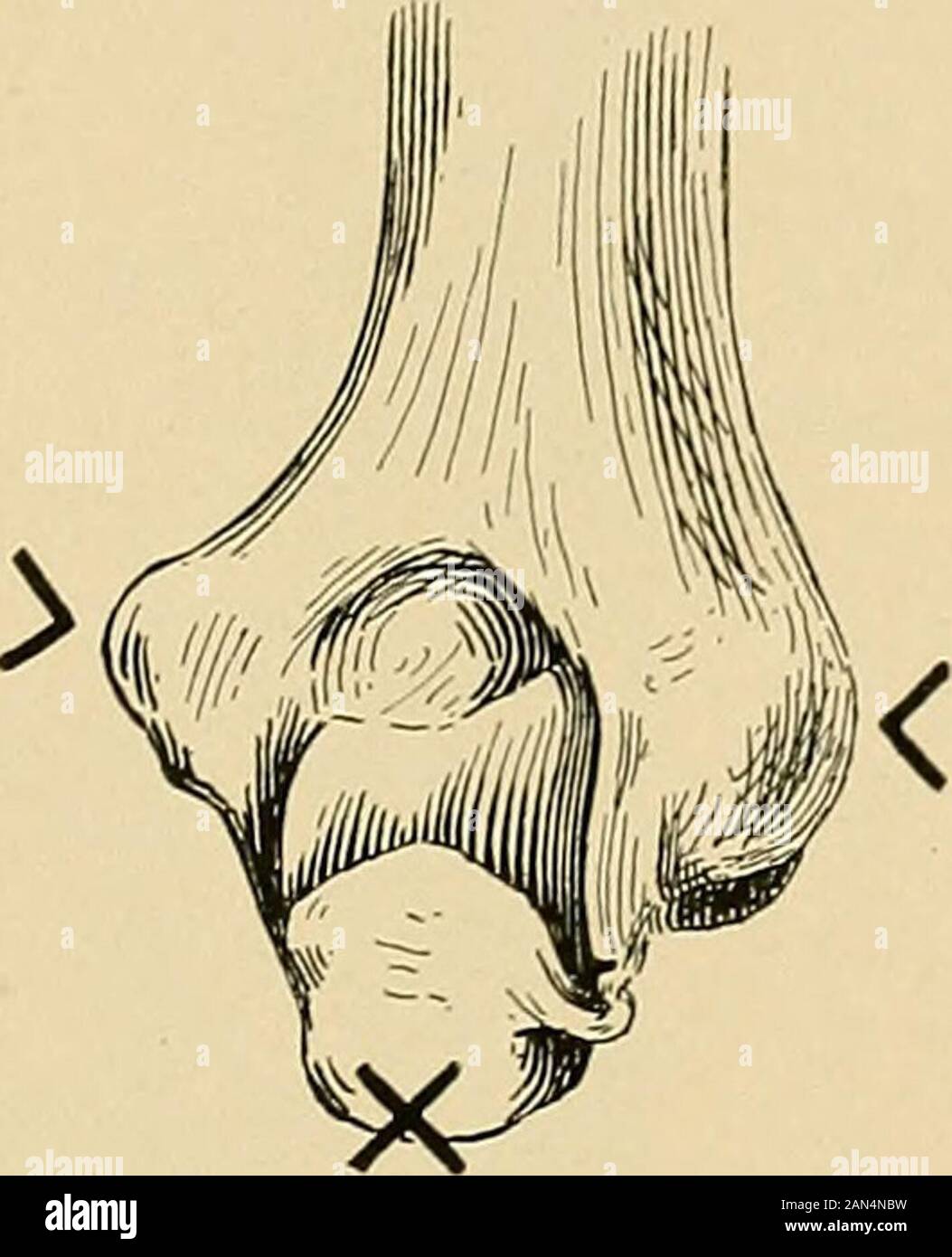 The treatment of fractures . Fig. 187.—The relations of the three bony ...