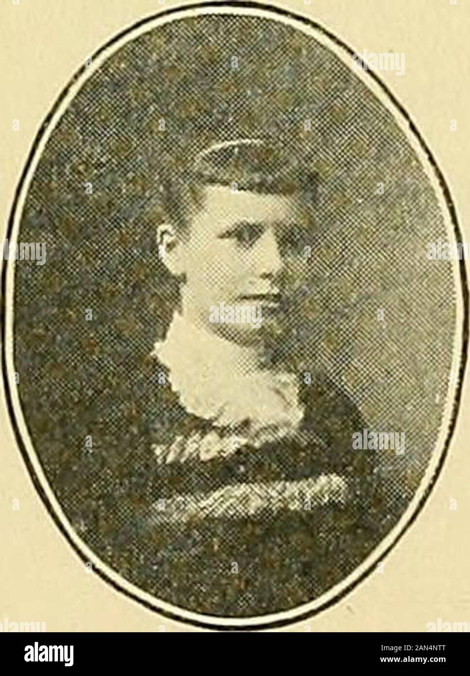 Types of mental defectives . Case N Stock Photo - Alamy