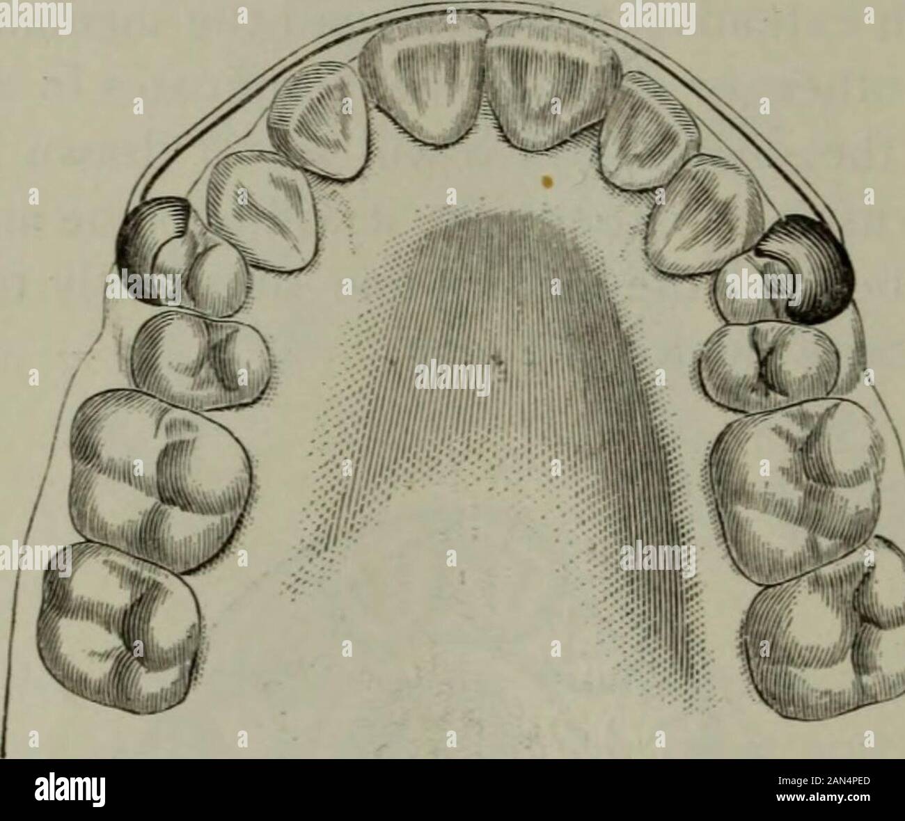 Labial superior hi-res stock photography and images - Alamy