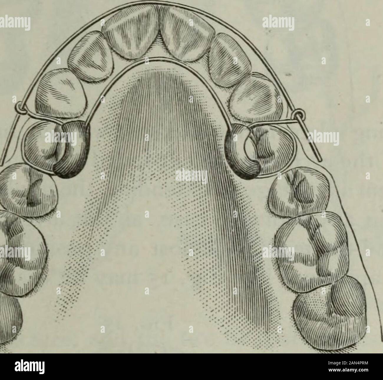 Foundation anchors hi-res stock photography and images - Alamy