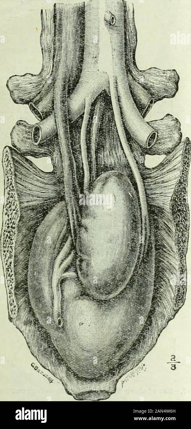 Appendix Location Variation