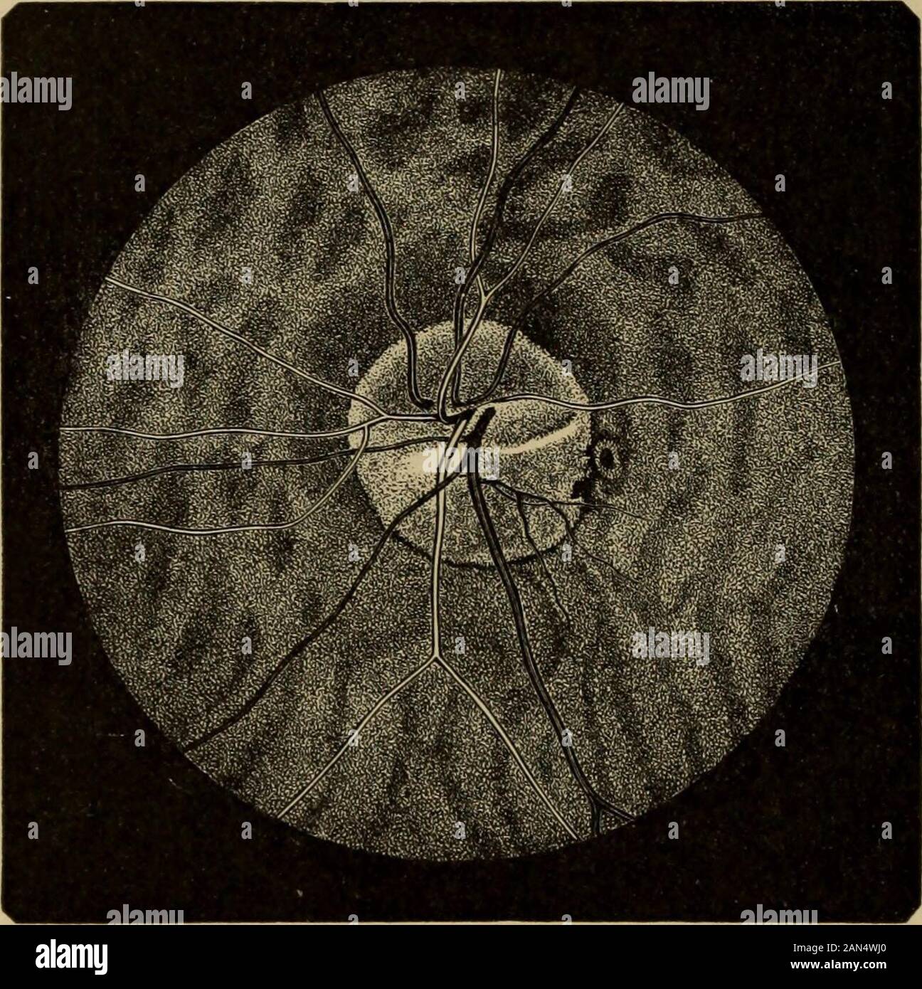 Text-book of ophthalmology . e border ofthe papilla, have been drawn up ...
