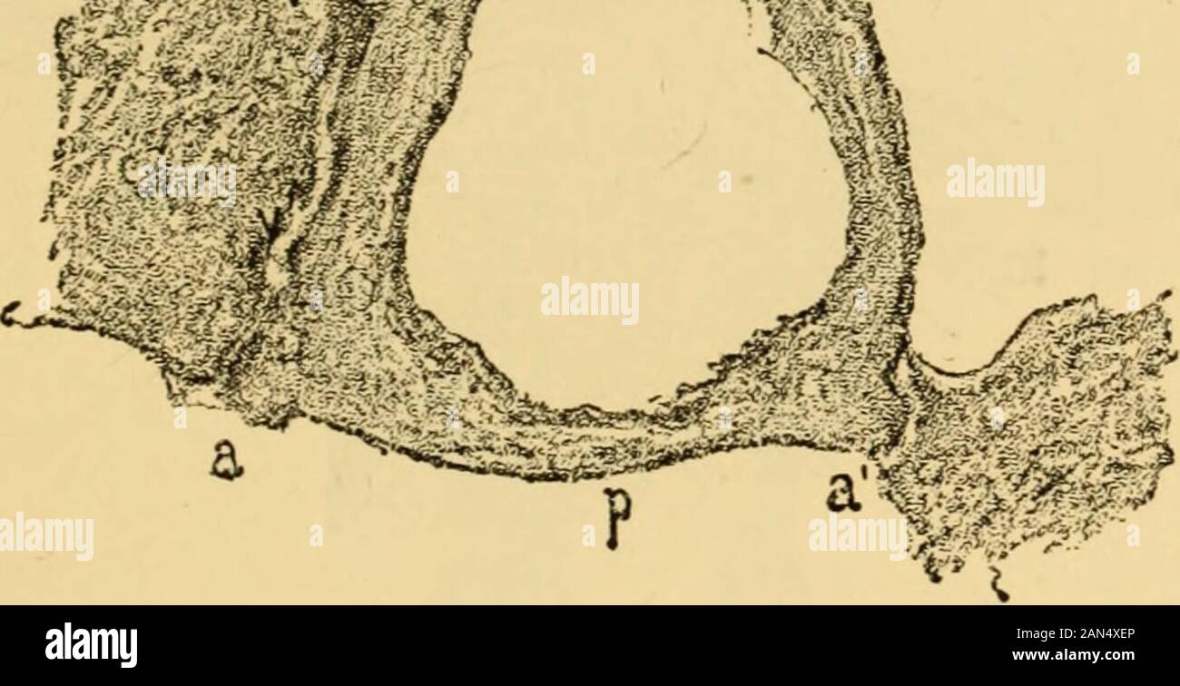 Anchylosis hi-res stock photography and images - Alamy