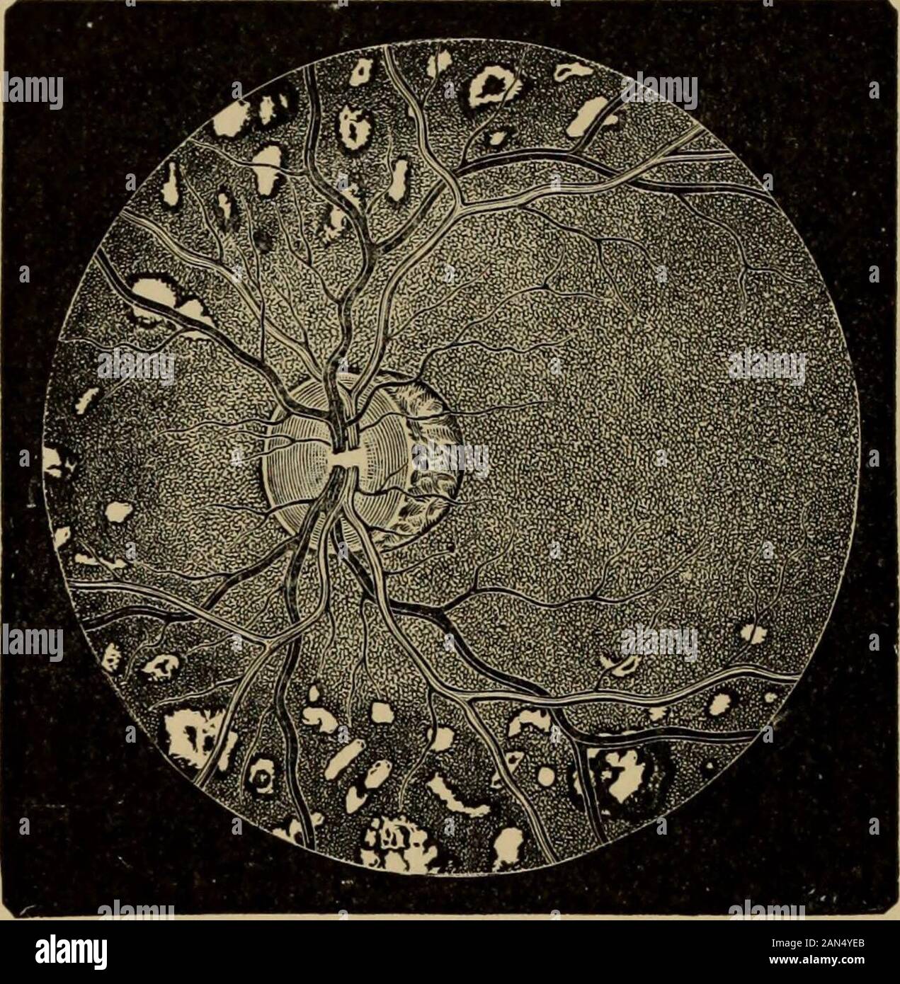 Contusions eye hi-res stock photography and images - Alamy