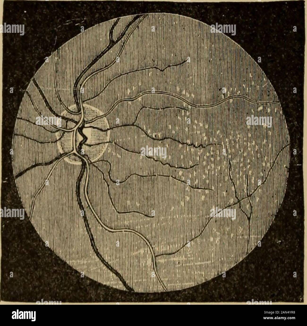 Macula lutea hi-res stock photography and images - Alamy