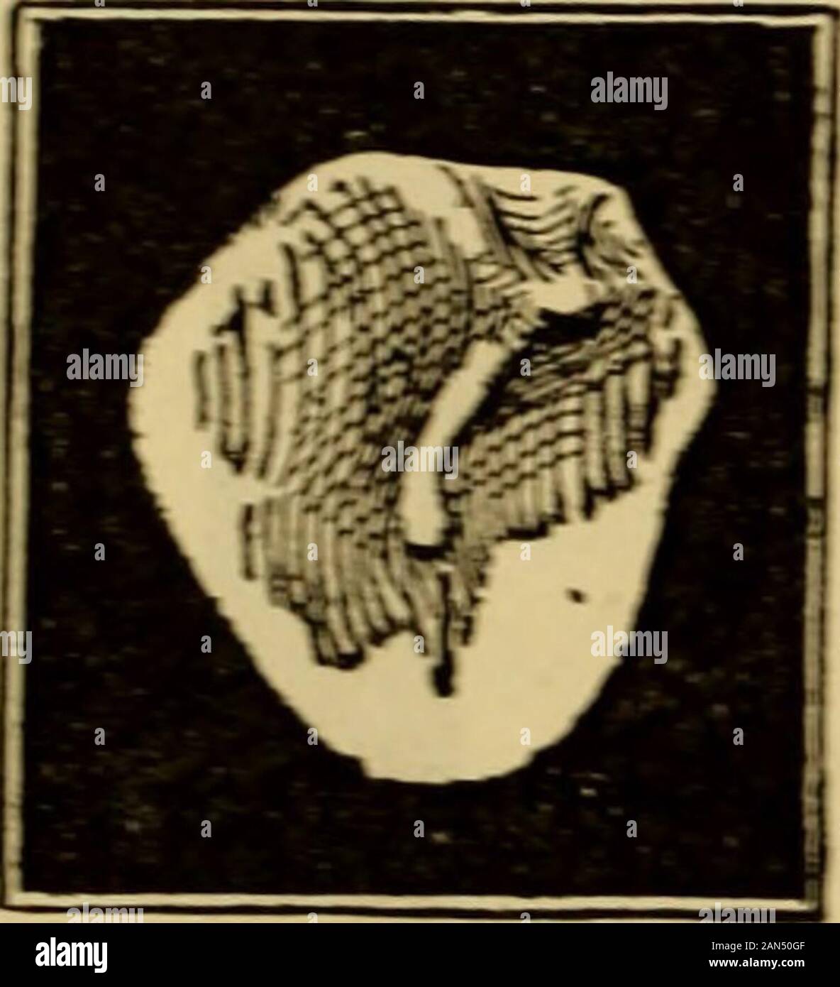 Paracentesis hi-res stock photography and images - Alamy