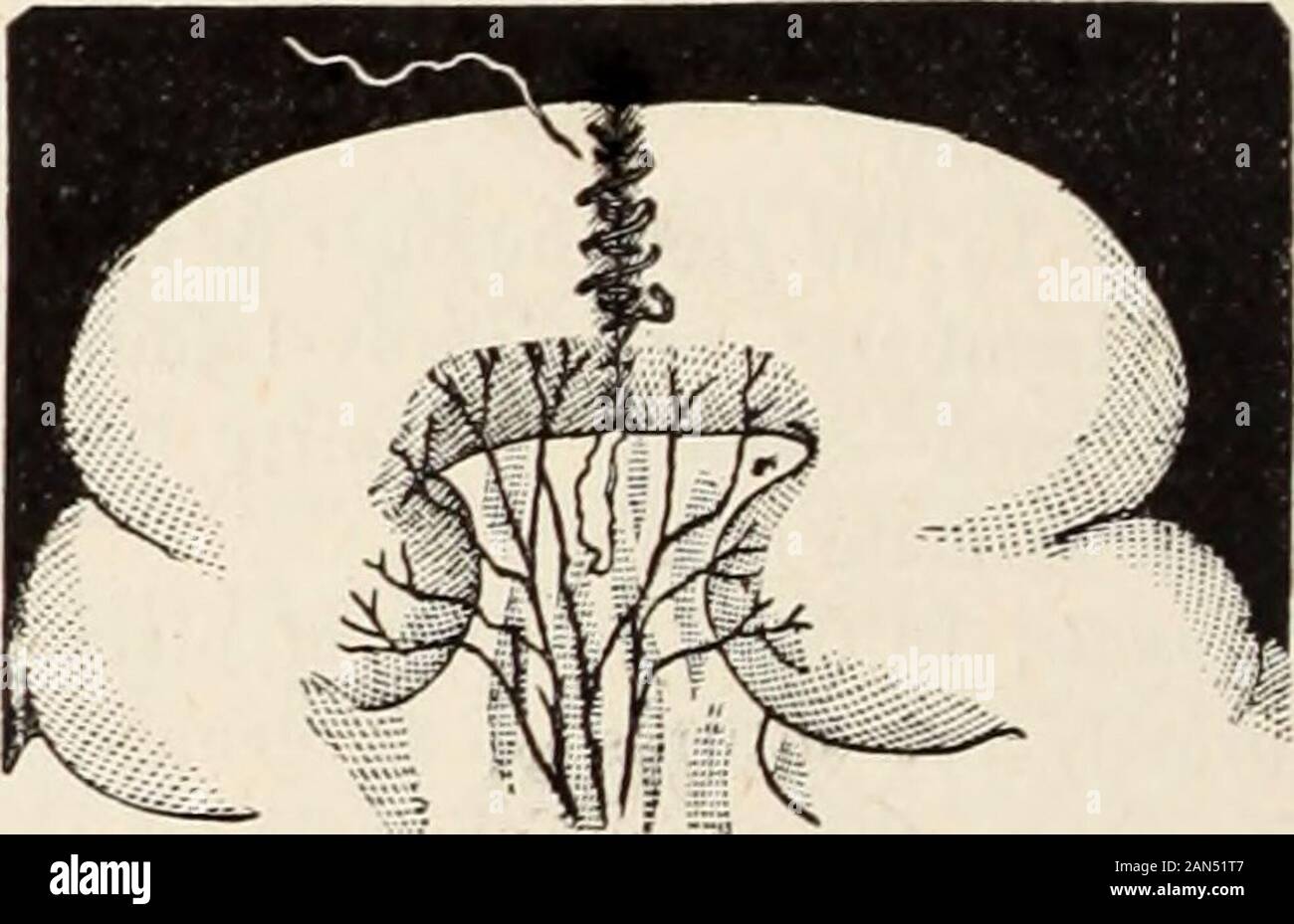 Excised suture hi-res stock photography and images - Alamy