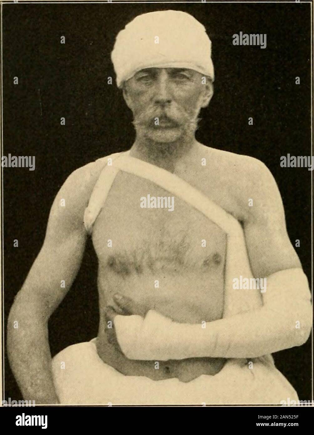 Gauze wadding hi-res stock photography and images - Alamy